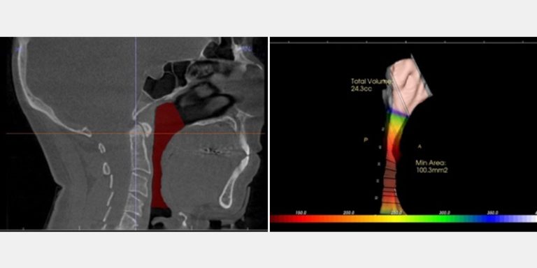 CBCT: A Window Into ‘Why’ - Spear Education