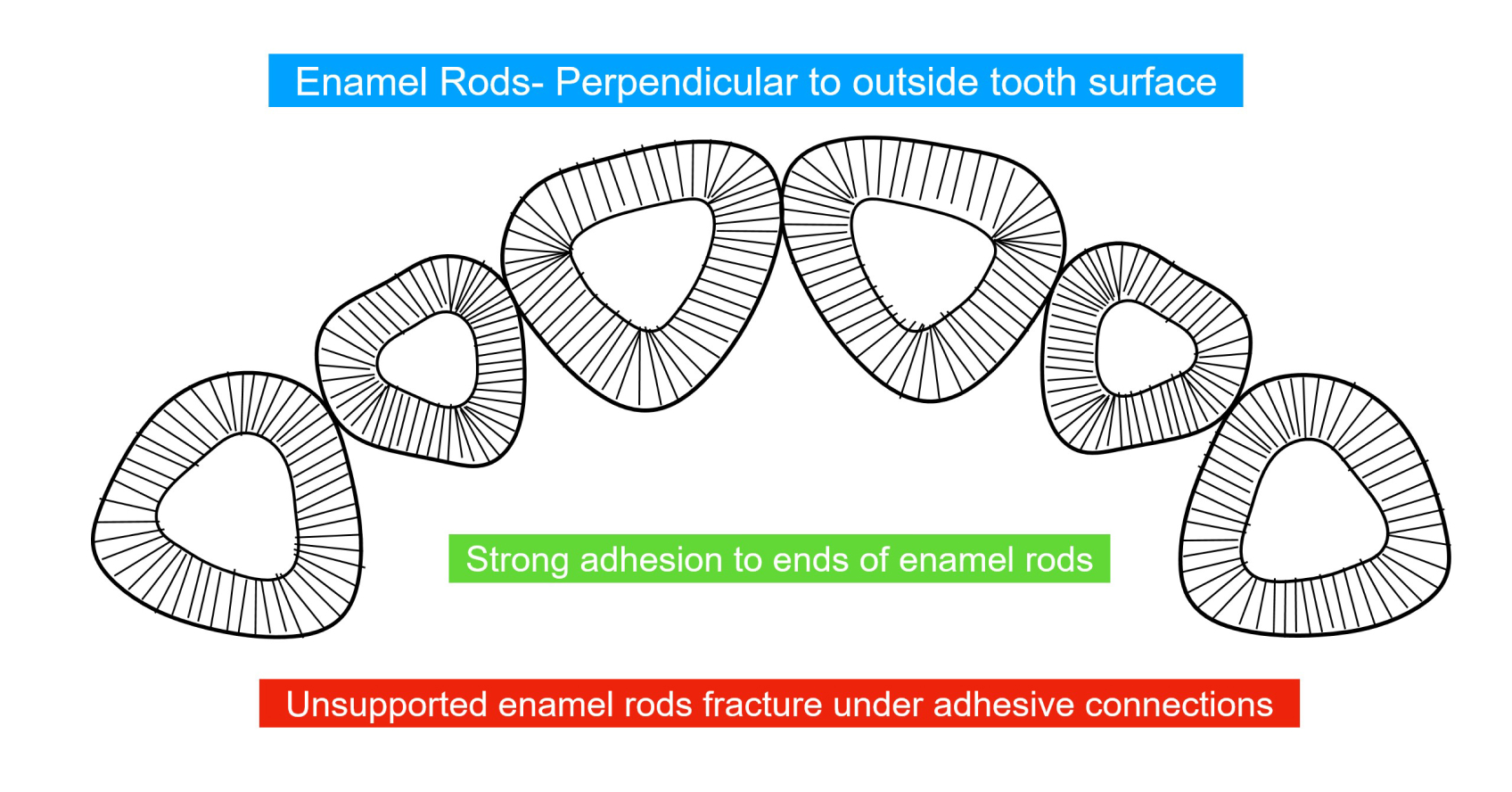 Enamel Rods: The Key to Successful Restorative Adhesion - Spear Education