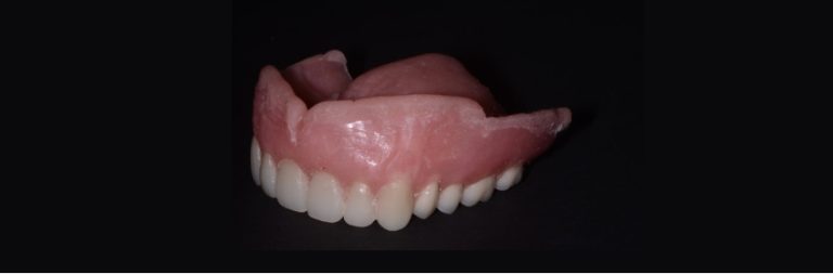 A Primer on Soft Denture Liners - Spear Education