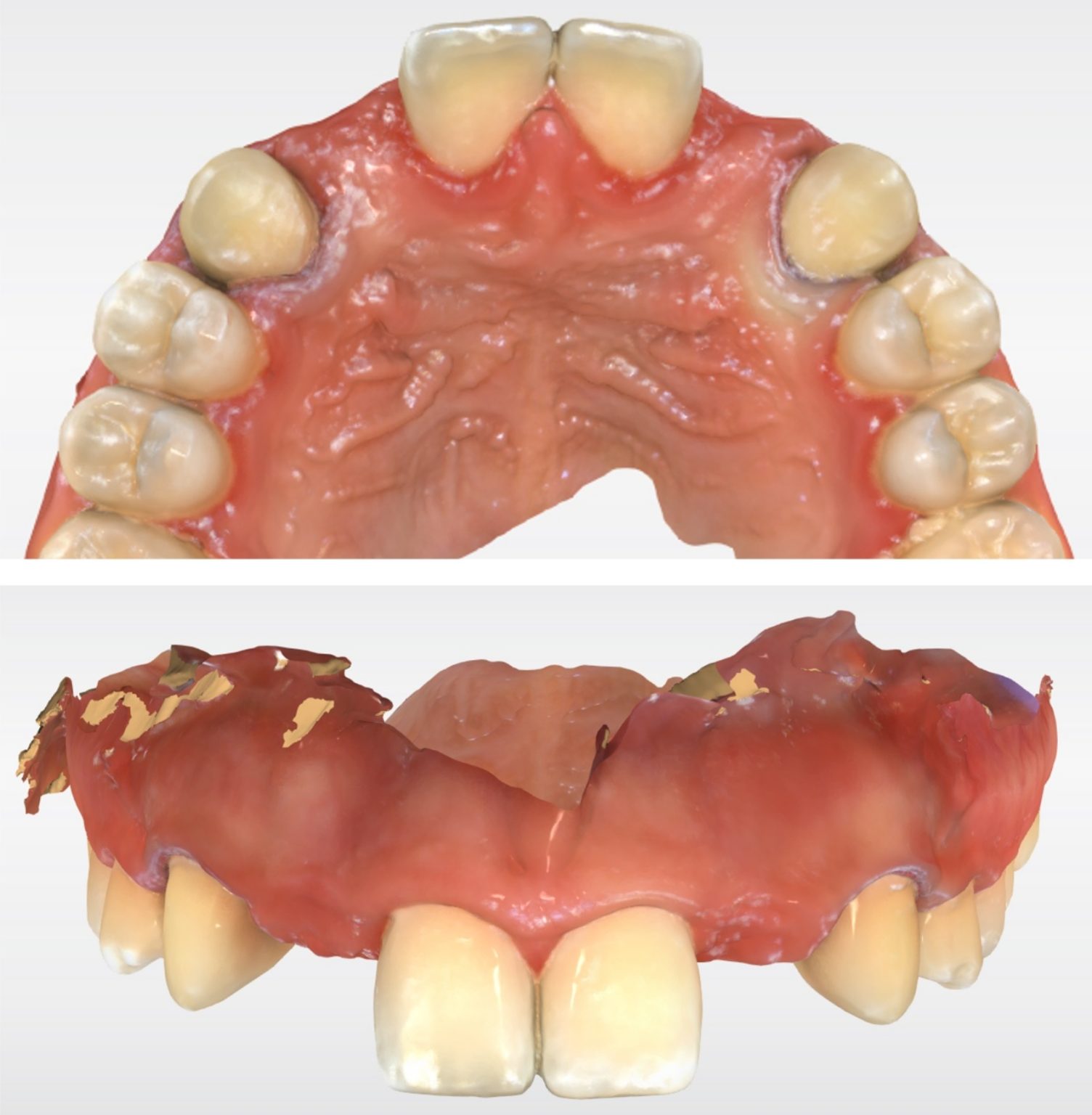 Three Solutions for Congenitally Missing Lateral Incisors: A Photo ...