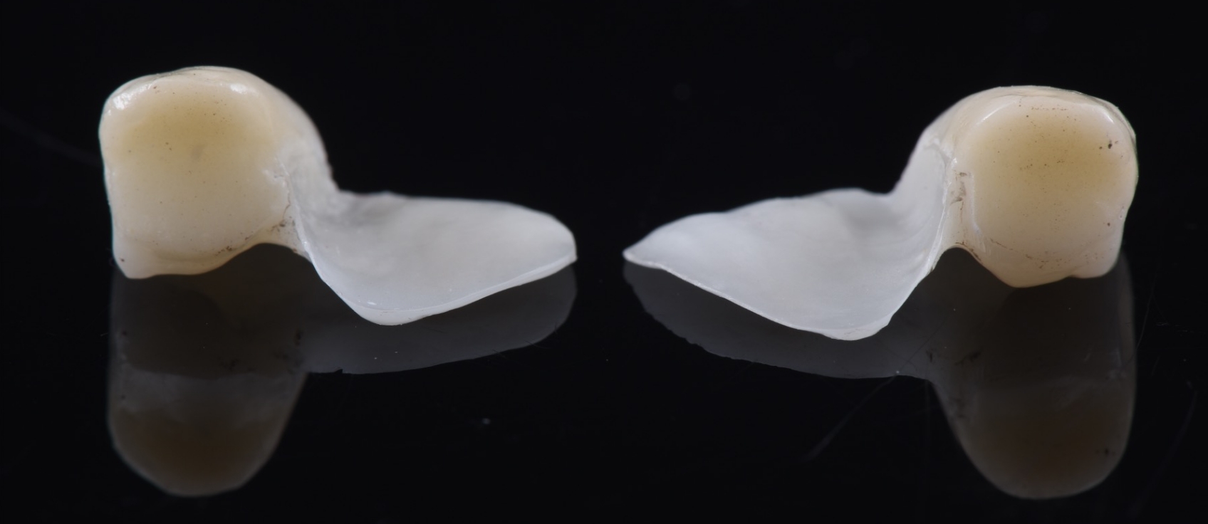 Three Solutions for Congenitally Missing Lateral Incisors: A Photo ...