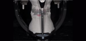 The Importance and Strategy Behind Custom Incisal Guide Tables - Spear ...