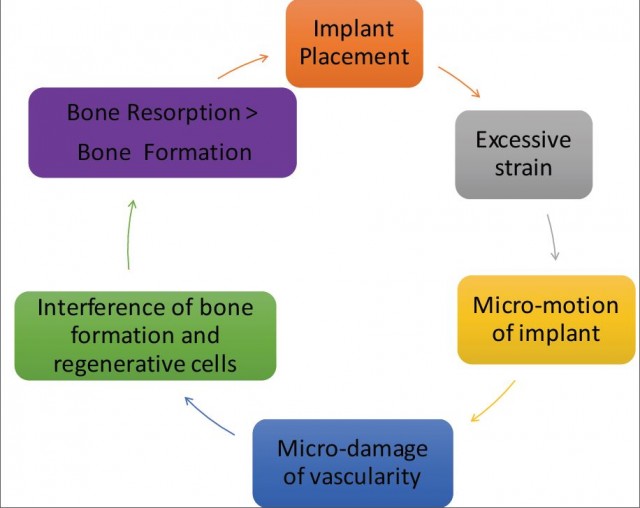 Immediate vs. Delayed Implant Loading - Spear Education